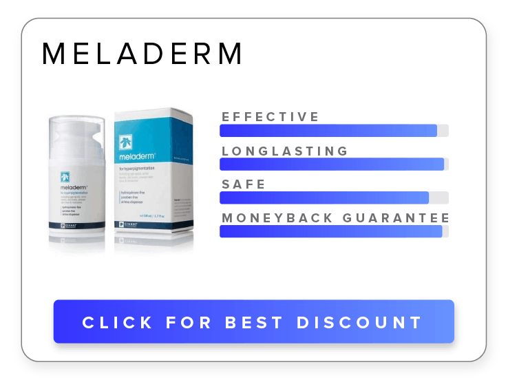 Meladerm Review: Hyperpigmentation Cream You Must Try!
