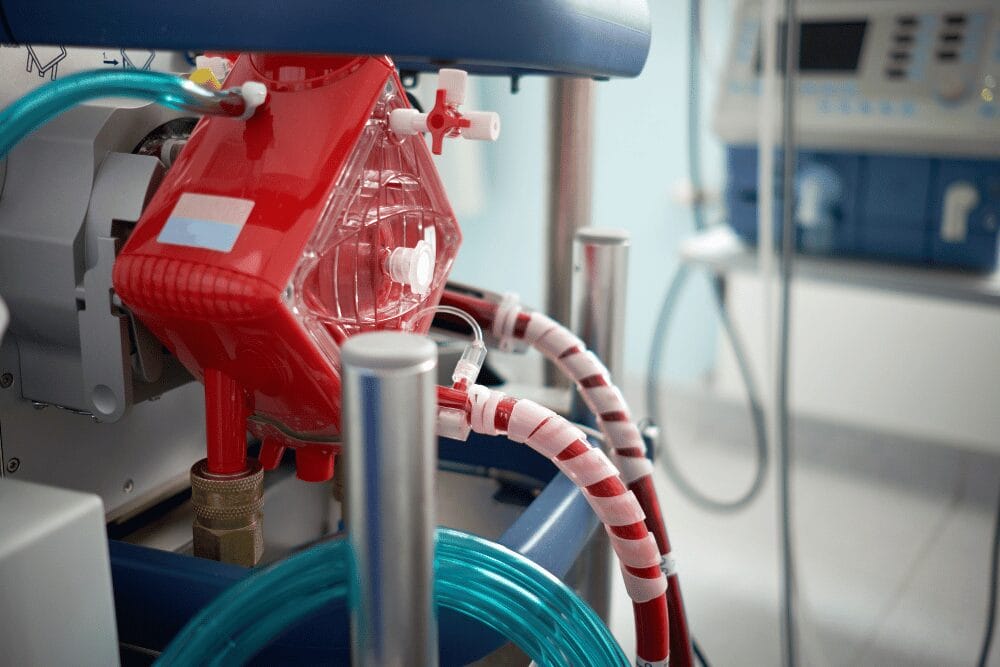 Top Three Considerations When Establishing An ECMO Program - Healthcare ...